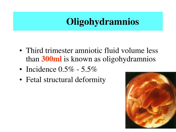 PPT - Fetal distress PowerPoint Presentation - ID:2939662