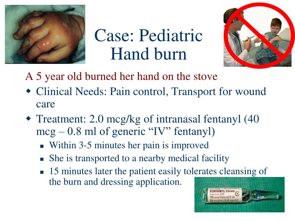 PPT - Intranasal Drug Delivery – Clinical Implications for EMS ...