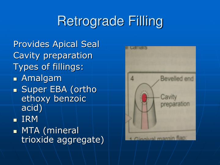 PPT - Acute Alveolar Osteitis PowerPoint Presentation - ID:2940458