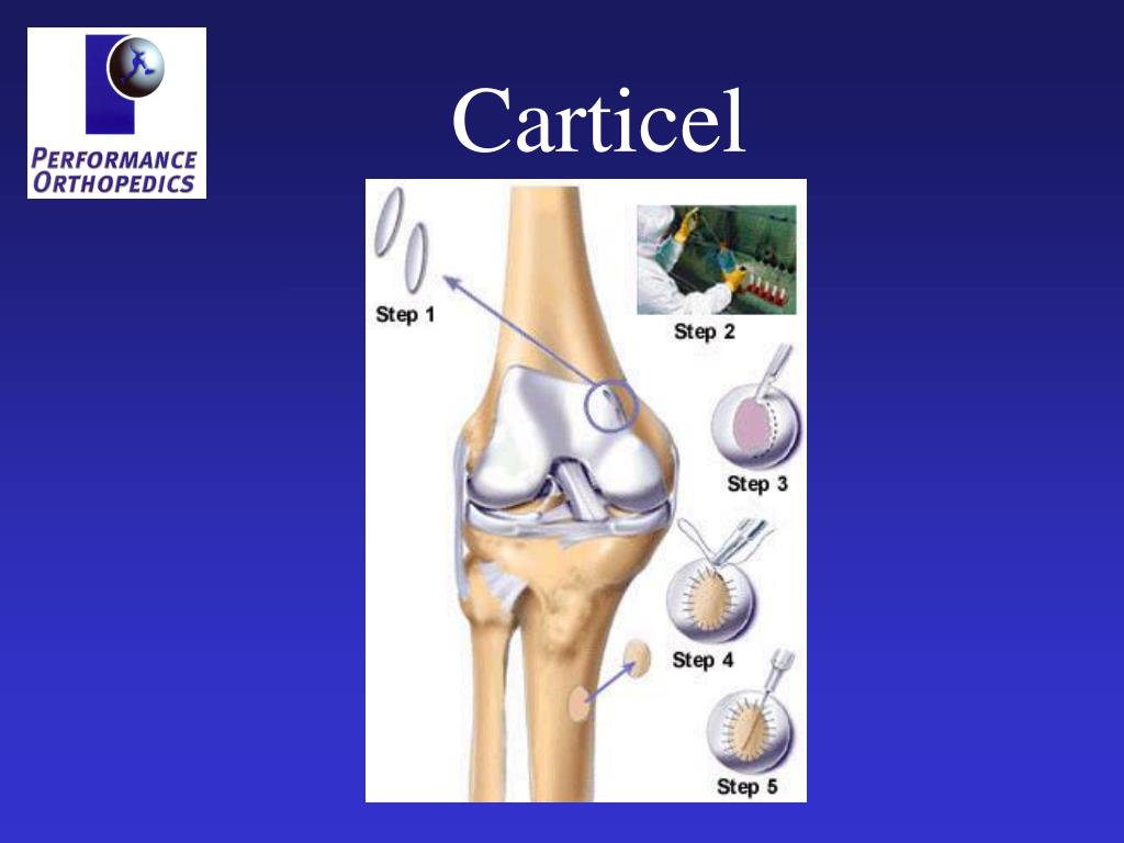 PPT - Beaumont Doctors Specializing in Sports Medicine PowerPoint ...