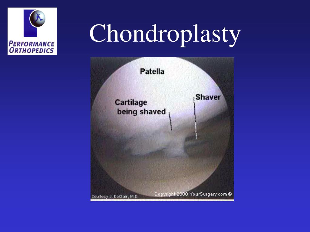 PPT - Beaumont Doctors Specializing in Sports Medicine PowerPoint ...