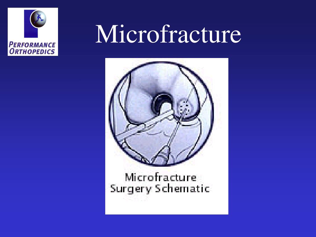 PPT - Beaumont Doctors Specializing in Sports Medicine PowerPoint ...