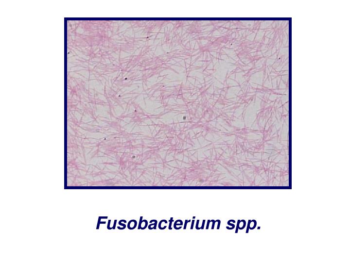 PPT - BACTERIAS ANAEROBIAS PowerPoint Presentation - ID:2941803