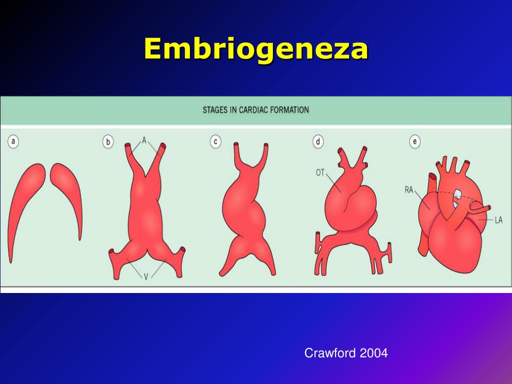 PPT - Cardiopatiile congenitale ale adultului PowerPoint Presentation ...