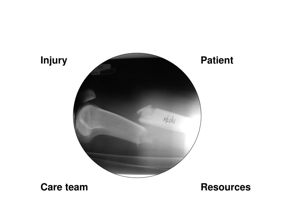 PPT - Pelvic Fractures 2 nd Northern Trauma Network Conference ...
