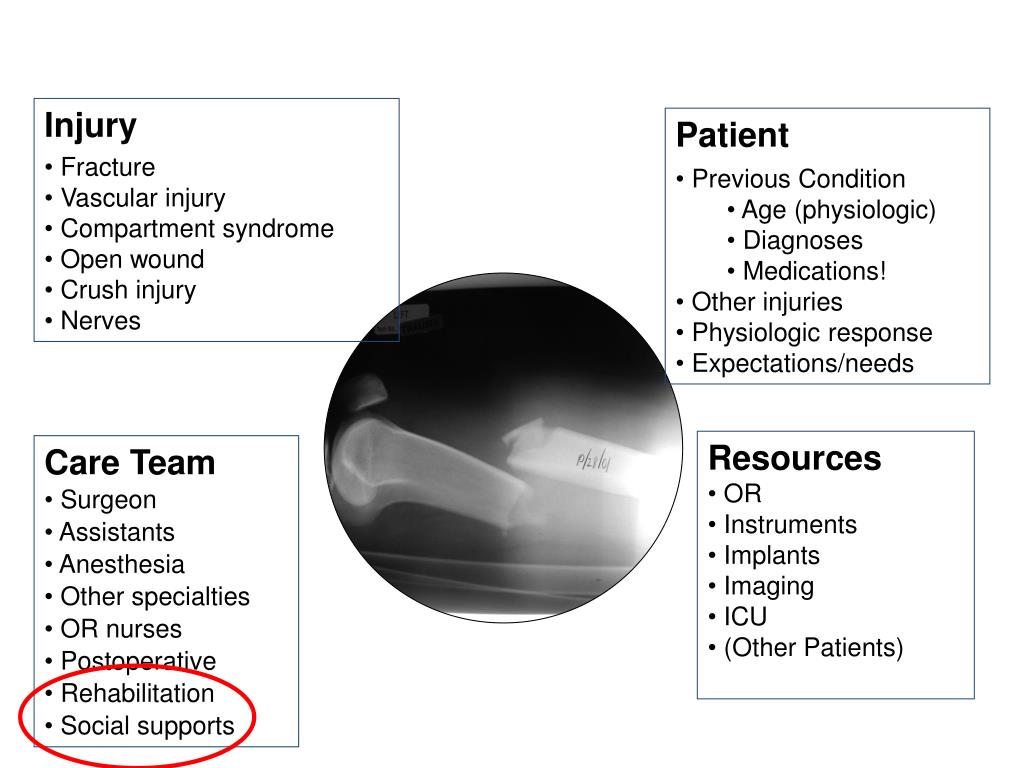 PPT - Pelvic Fractures 2 nd Northern Trauma Network Conference ...