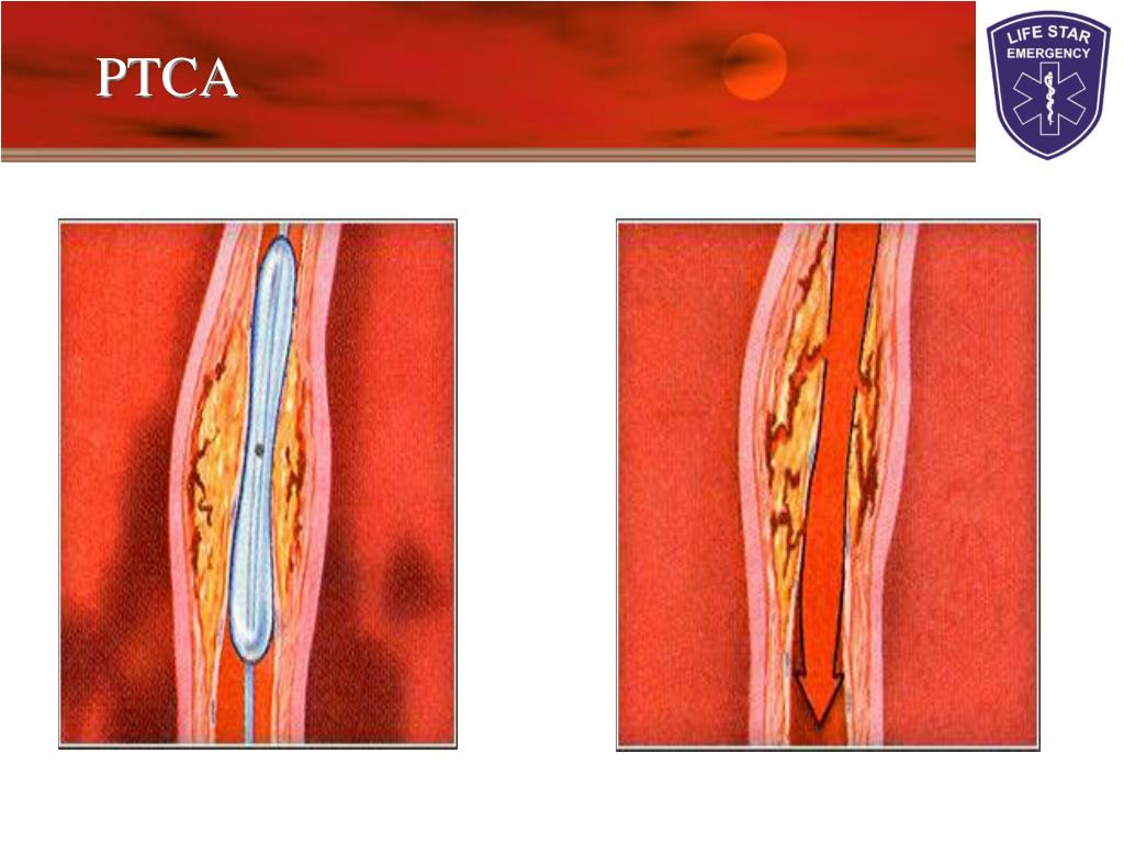 PPT - Táňa Bulíková, Viliam Dobiáš Life Star Emergency, spol. s r.o ...