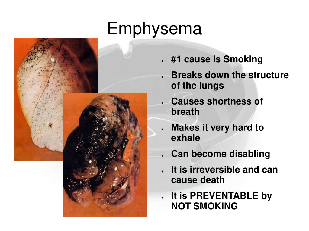 PPT - The Affects of Tobacco Smoke on the Human Body PowerPoint ...