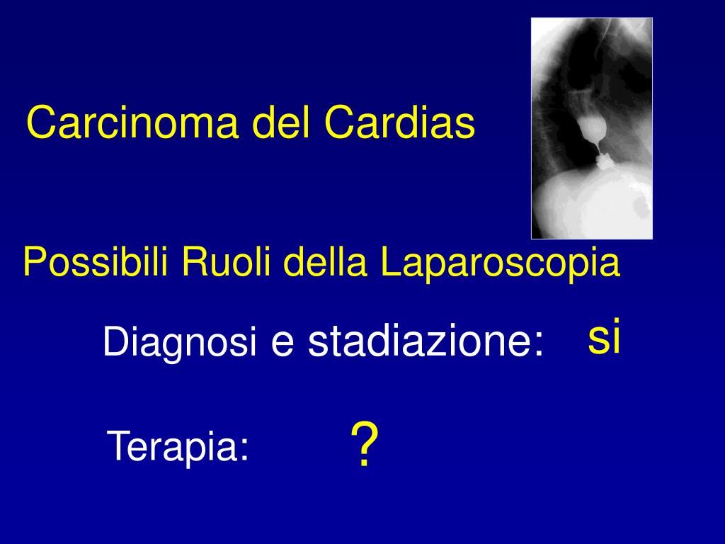 PPT - Ruolo della Laparoscopia nell’Adenocarcinoma del Cardias ...