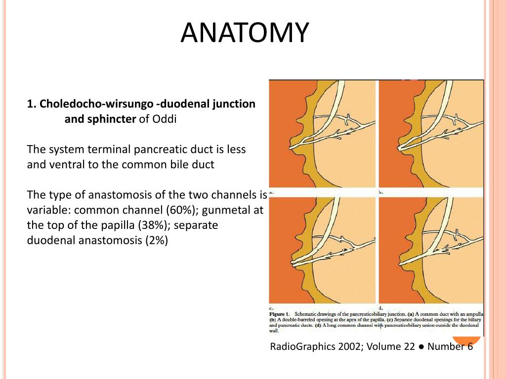 PPT - IMAGING AMPULLOMA OF VATER’S PAPILLE SERIES OF FIFTEEN CASES ...
