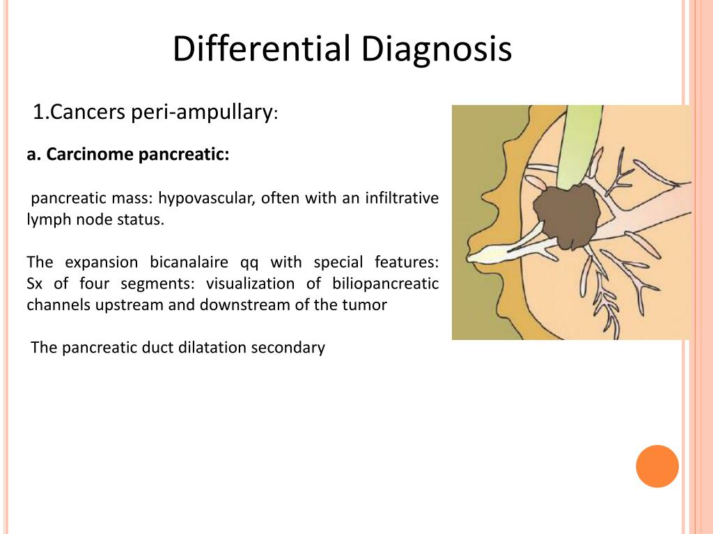 PPT - IMAGING AMPULLOMA OF VATER’S PAPILLE SERIES OF FIFTEEN CASES ...