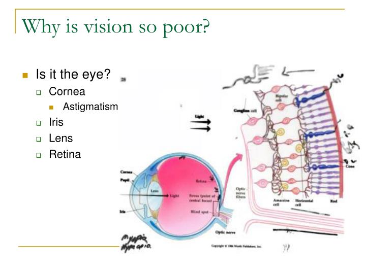 PPT - Visual Acuity Testing PowerPoint Presentation - ID:2947832