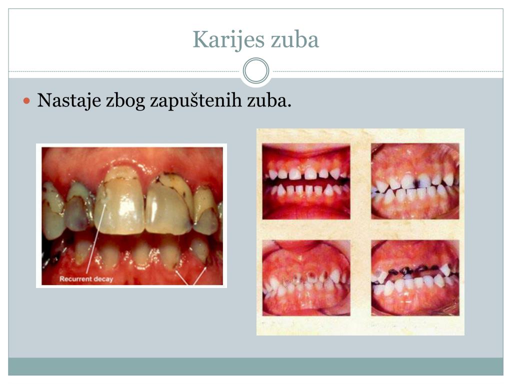 PPT - Bolesti organa za varenje PowerPoint Presentation, free download ...