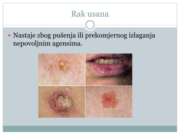 PPT - Bolesti organa za varenje PowerPoint Presentation - ID:2947902