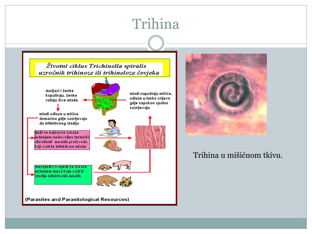 PPT - Bolesti organa za varenje PowerPoint Presentation, free download ...