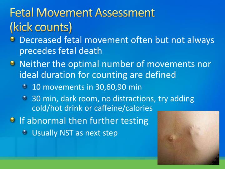 PPT - Antenatal Testing for High Risk Pregnancy PowerPoint Presentation ...