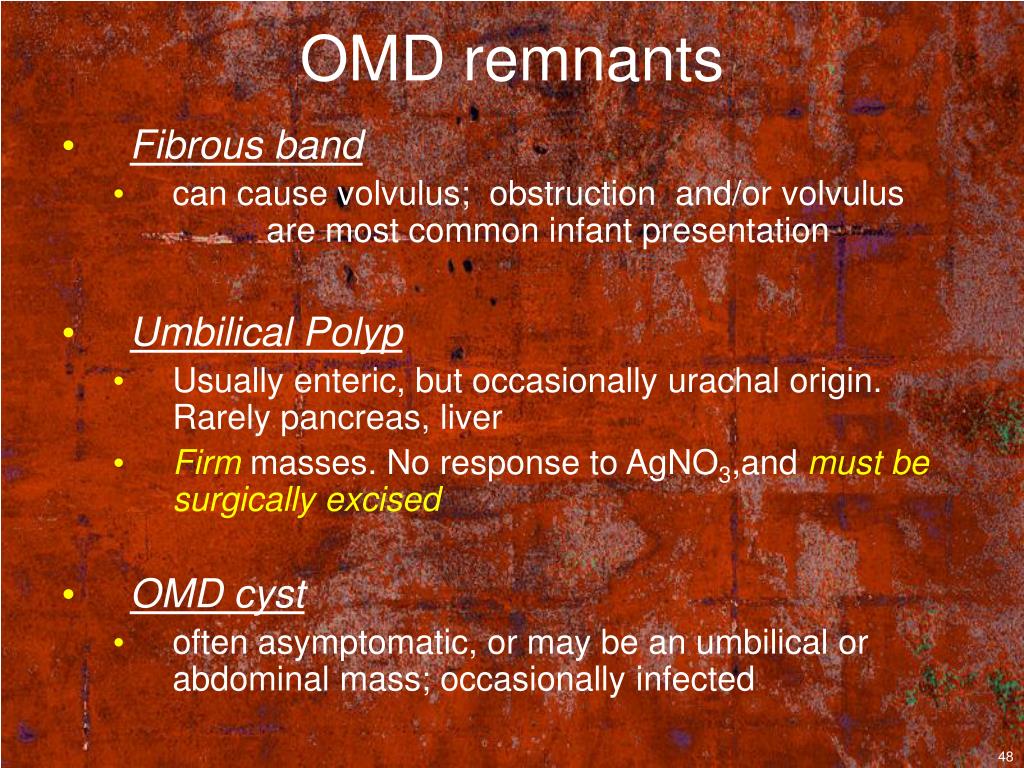PPT - Acute Umbilical Complaints in the Pediatric ER PowerPoint ...