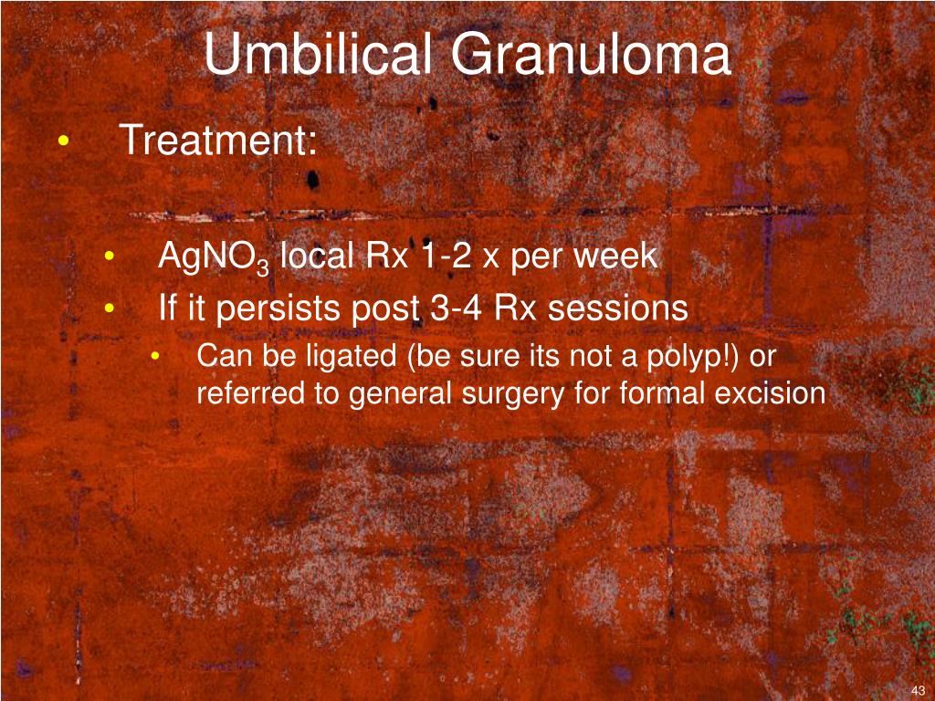 PPT - Acute Umbilical Complaints in the Pediatric ER PowerPoint ...