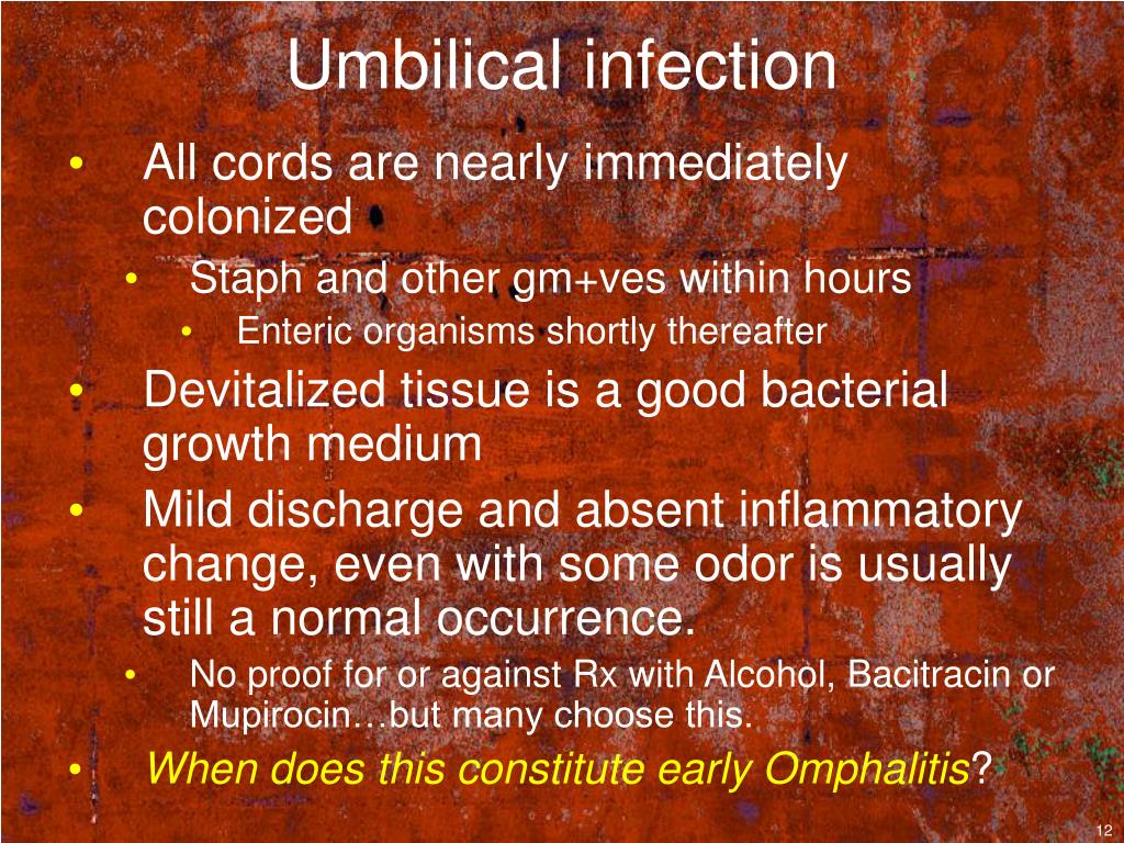 PPT - Acute Umbilical Complaints in the Pediatric ER PowerPoint ...