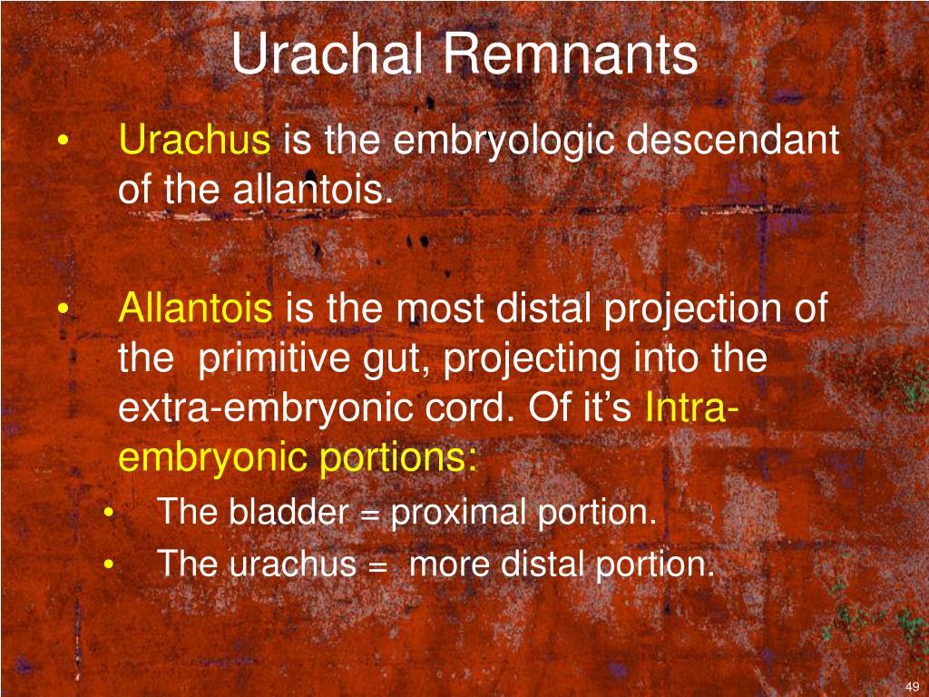 PPT - Acute Umbilical Complaints in the Pediatric ER PowerPoint ...