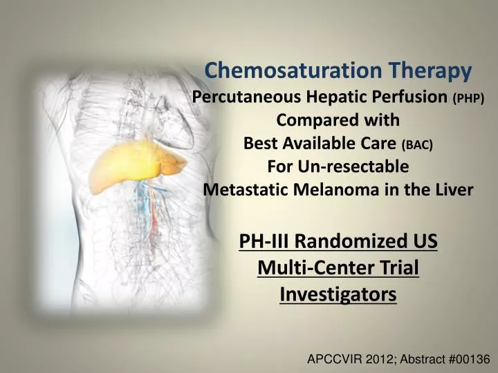 PPT - Chemosaturation Therapy Percutaneous Hepatic Perfusion (PHP ...