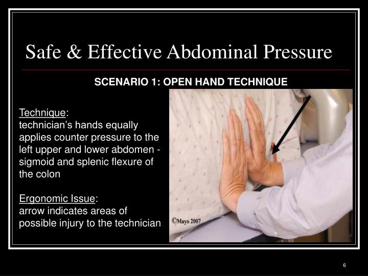 PPT - Safe & Effective Abdominal Pressure During Colonoscopy: Forearm ...