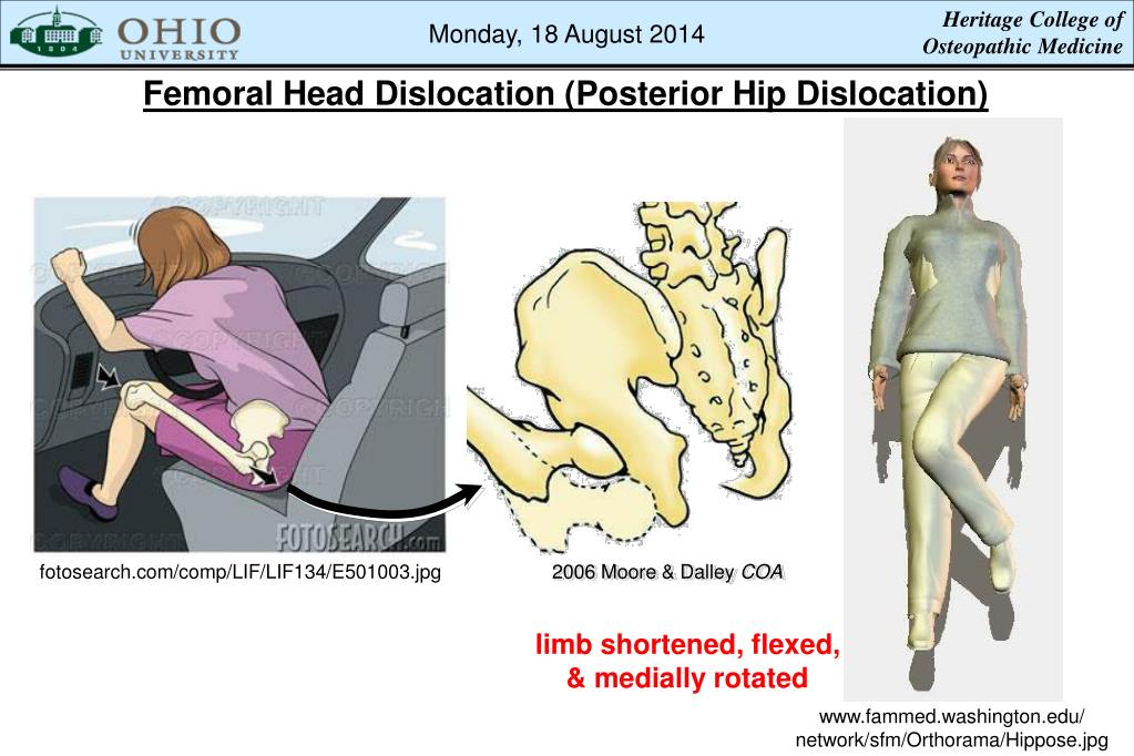 PPT - Heritage College of Osteopathic Medicine PowerPoint Presentation ...