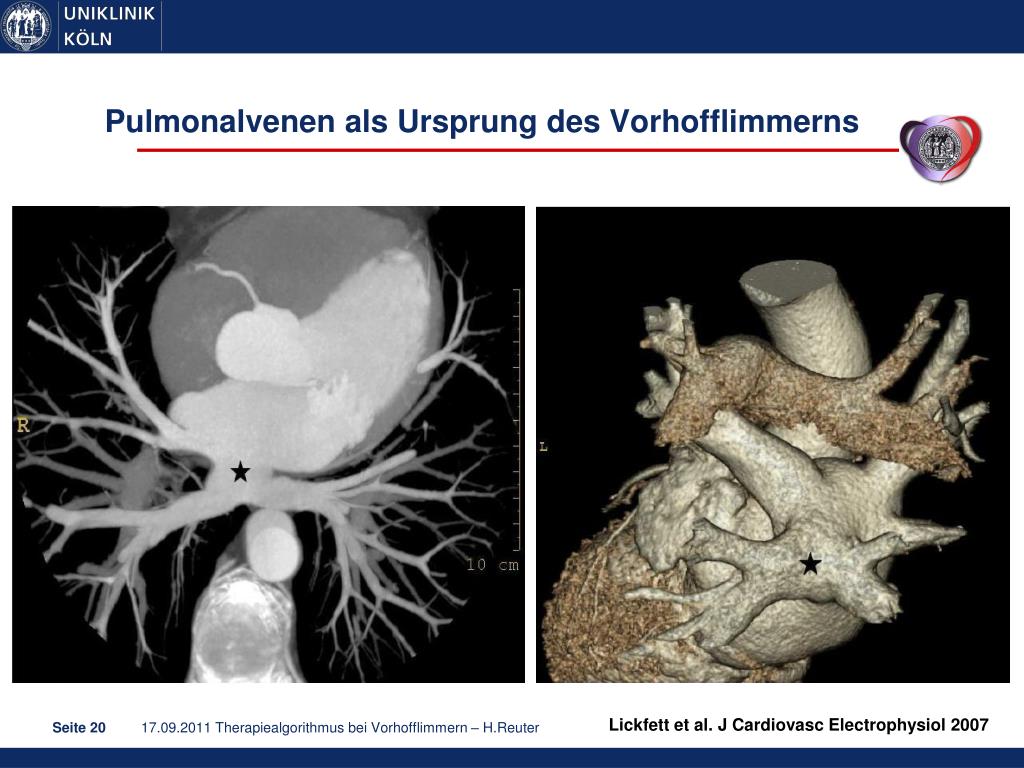 PPT - Hannes Reuter Klinik III für Innere Medizin Herzzentrum der ...