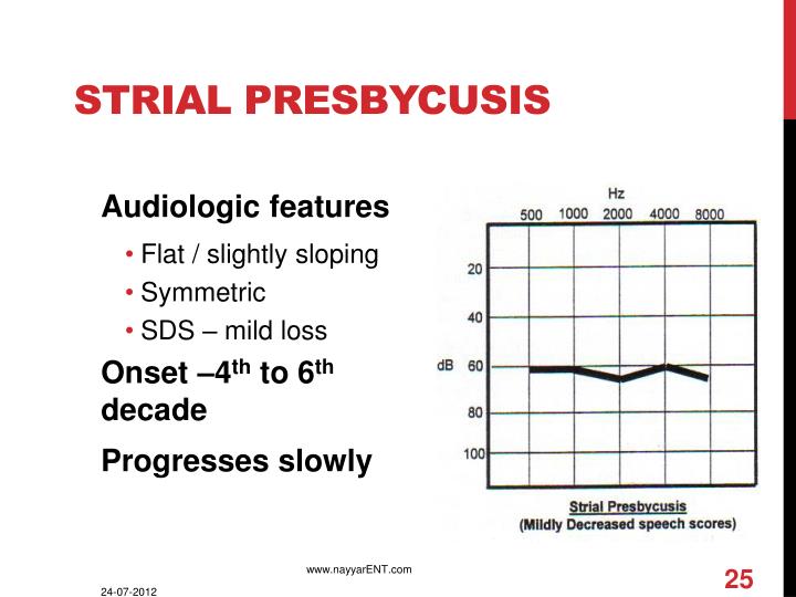 PPT - PRESBYCUSIS PowerPoint Presentation - ID:2957165