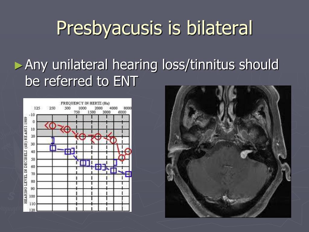 PPT - Hearing Deficits in Older People PowerPoint Presentation, free ...