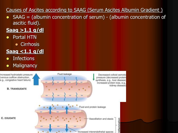 PPT - ASCITES Abnormal accumulation of fluid in the peritoneal cavity ...