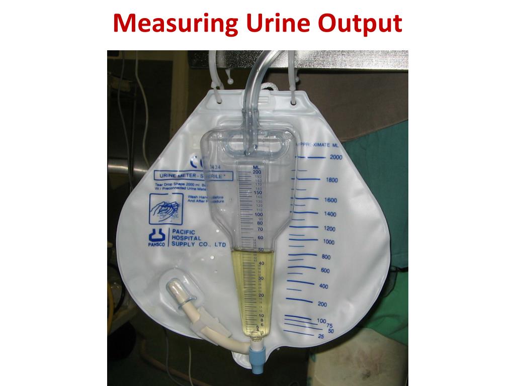 How To Calculate Urine Output How To Calculate Urine Output