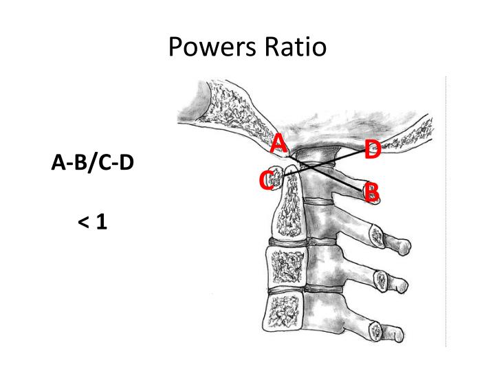 PPT - Pediatric Trauma C-Spine X-Ray PowerPoint Presentation - ID:2963543