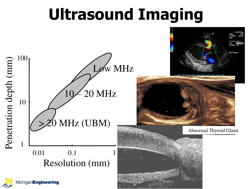 PPT - Shai Ashkenazi Biomedical Ultrasound Lab Dept. Biomedical ...