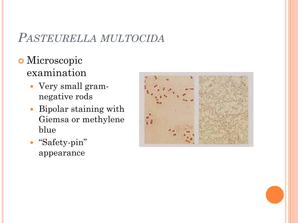 Pasteurella Multocida Bipolar Staining