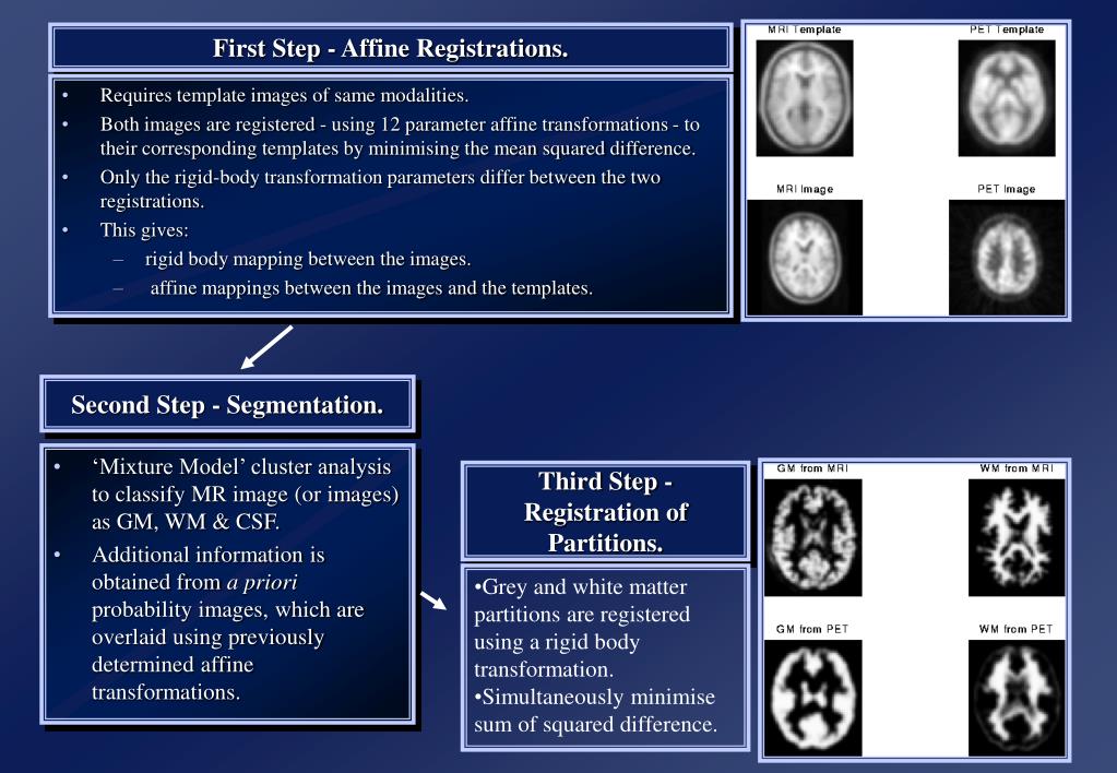 PPT - Computational Neuroanatomy John Ashburner john@fil.ion.ucl.ac.uk ...