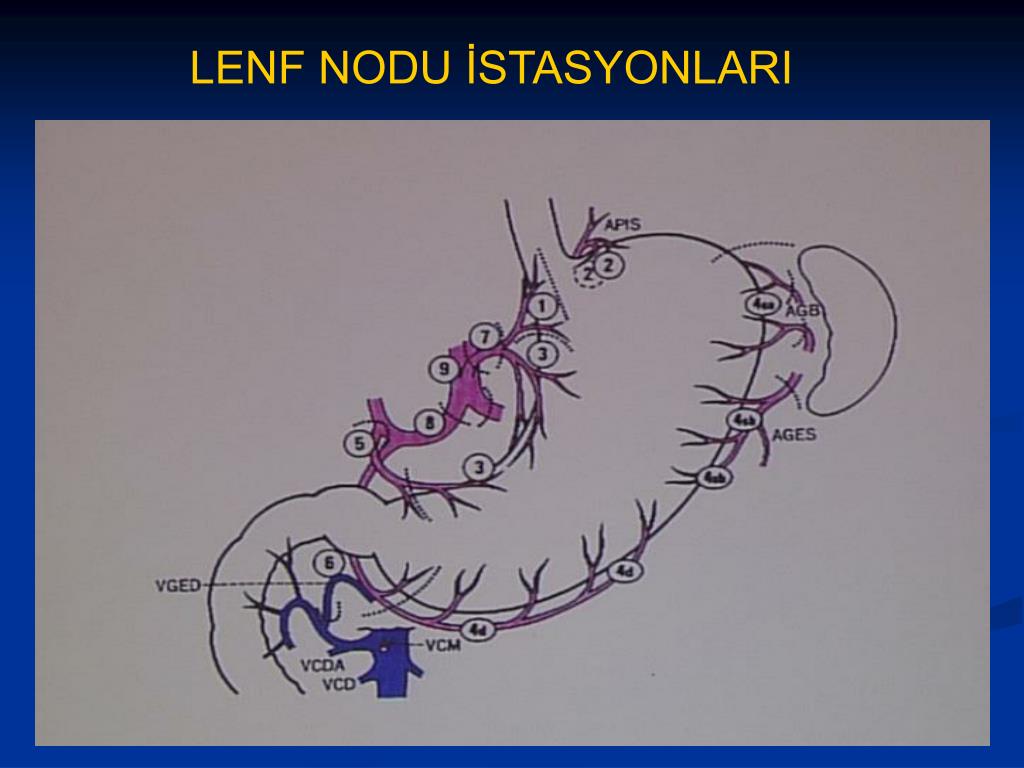 PPT - MİDE CERRAHİSİ ve POSTGASTREKTOMİ SENDROMLARI Prof. Dr. Cavit ÇÖL ...