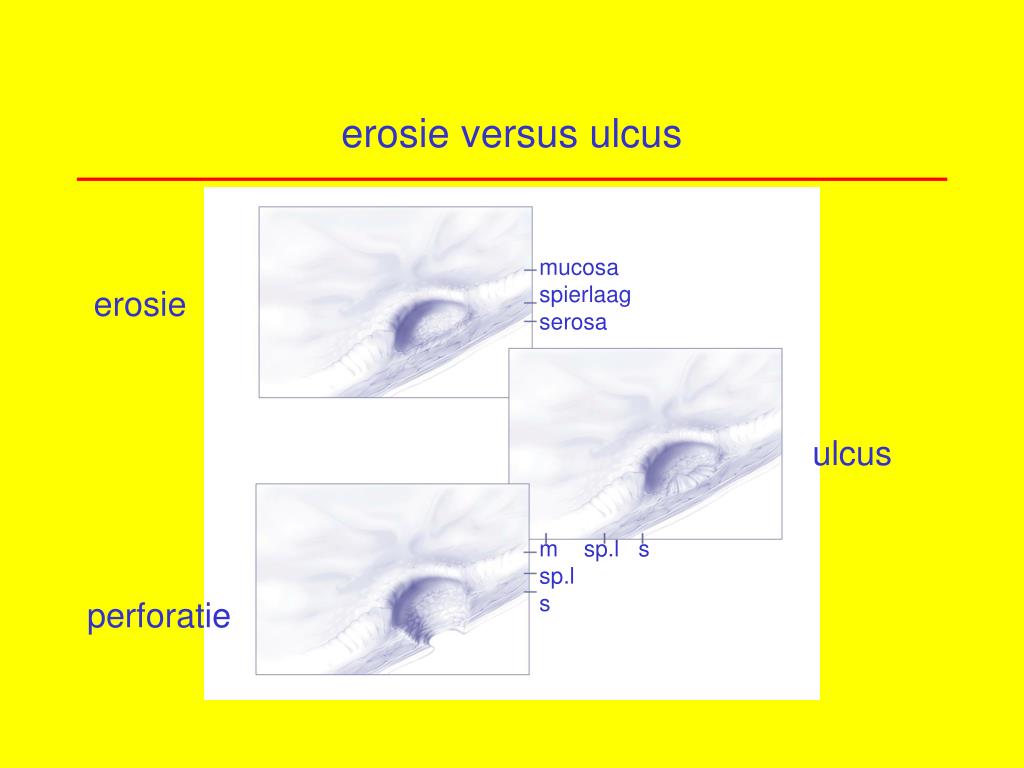 PPT - artrose Els-Heidi Bakker-voetman, medisch trainer afdeling ...