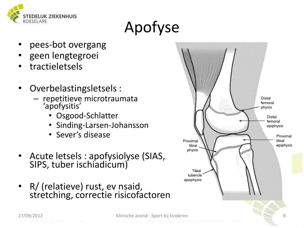 PPT - Klinische avond Sport bij kinderen: de ideale prikkel om gezond ...