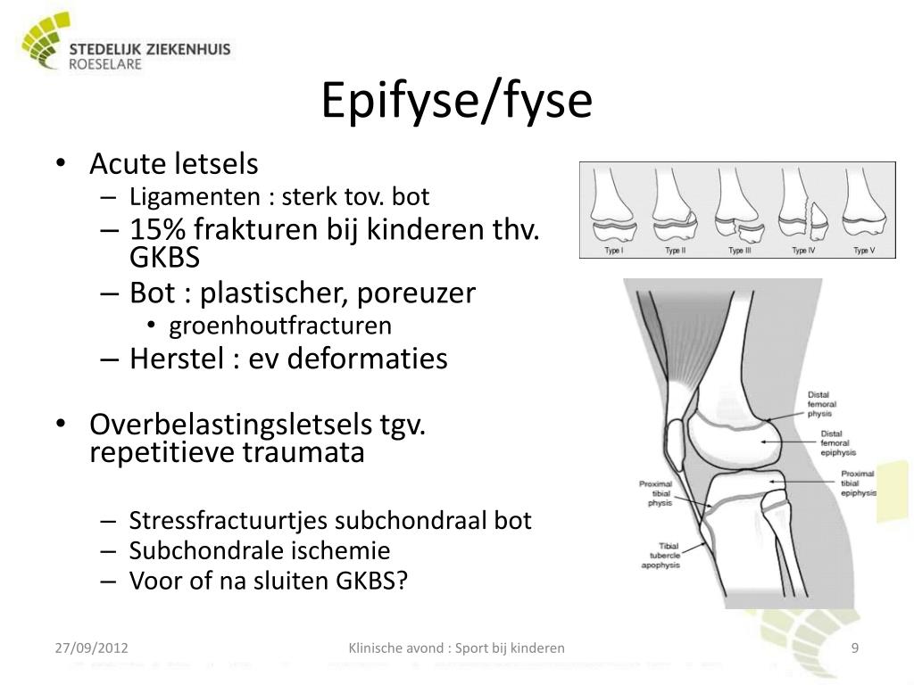 PPT - Klinische avond Sport bij kinderen: de ideale prikkel om gezond ...