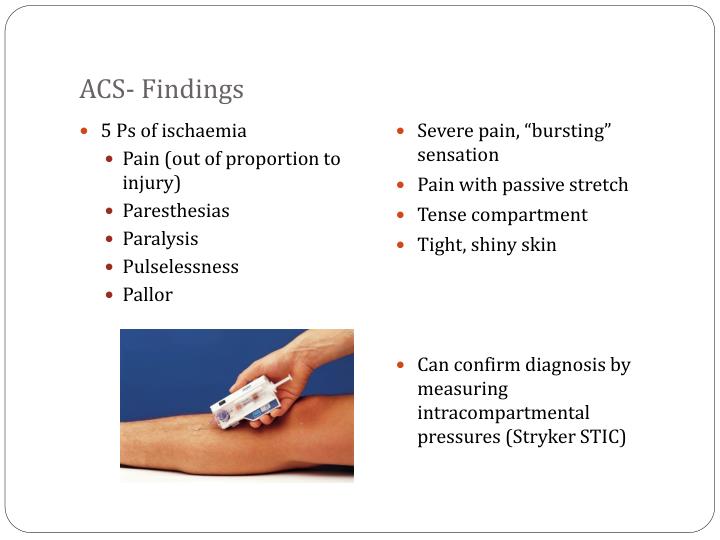 PPT - Orthopaedic Emergencies PowerPoint Presentation - ID:2966406