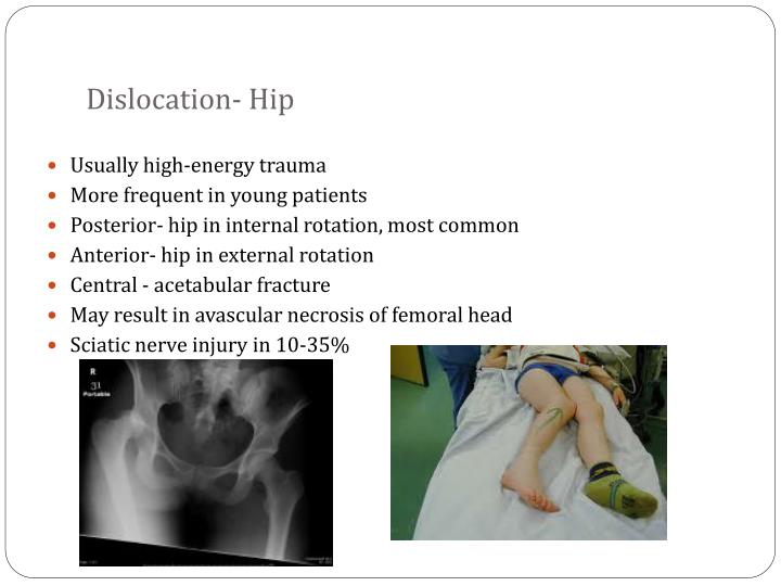 PPT - Orthopaedic Emergencies PowerPoint Presentation - ID:2966406