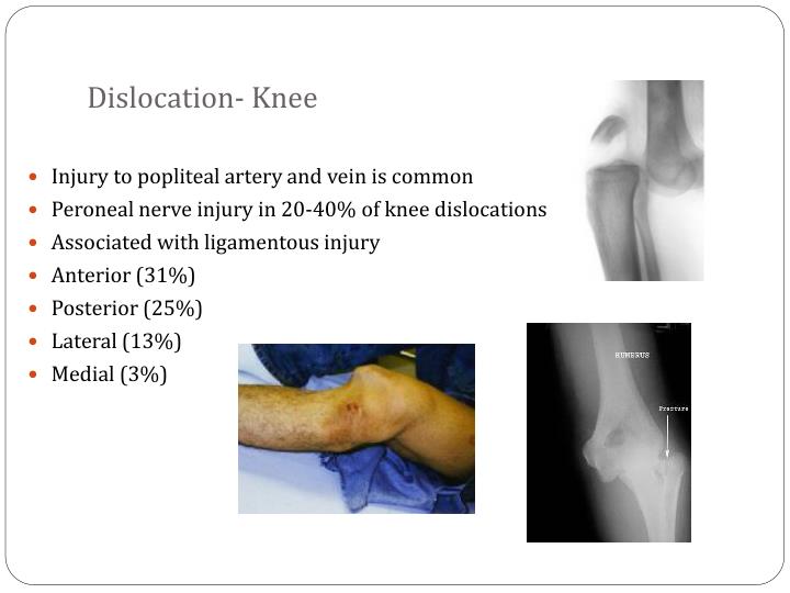PPT - Orthopaedic Emergencies PowerPoint Presentation - ID:2966406
