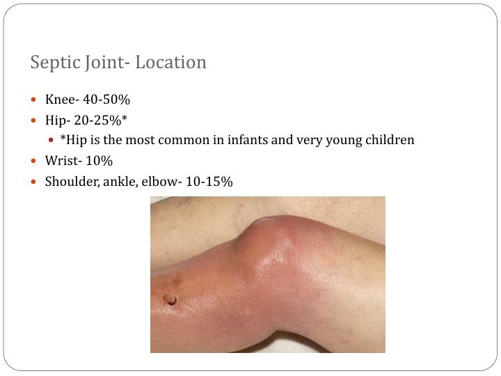 PPT - Orthopaedic Emergencies PowerPoint Presentation - ID:2966406