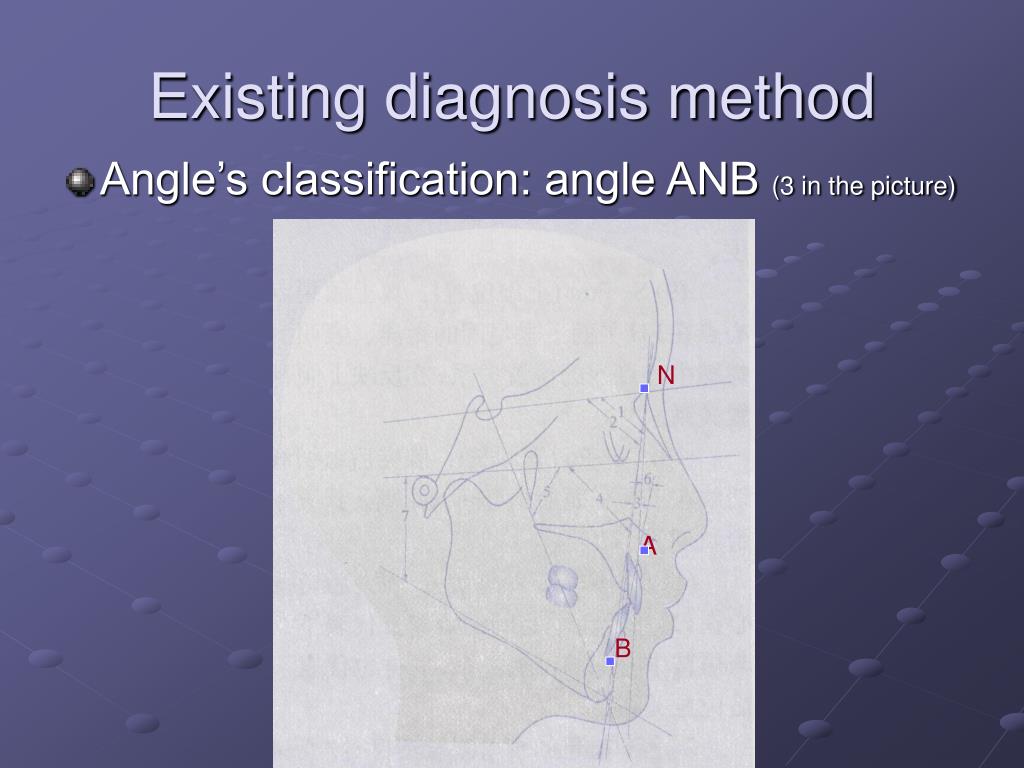 PPT - Utilizing V-Detector for Malocclusion Diagnosis in Dental ...