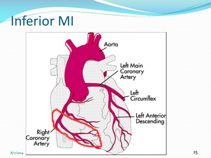 PPT - BASIC 12 LEAD ECG INTERPRETATION PowerPoint Presentation - ID:2966866