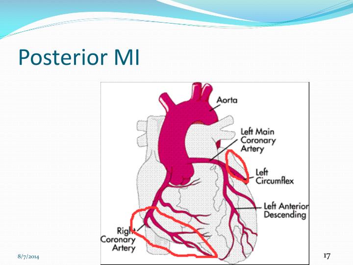 PPT - BASIC 12 LEAD ECG INTERPRETATION PowerPoint Presentation - ID:2966866