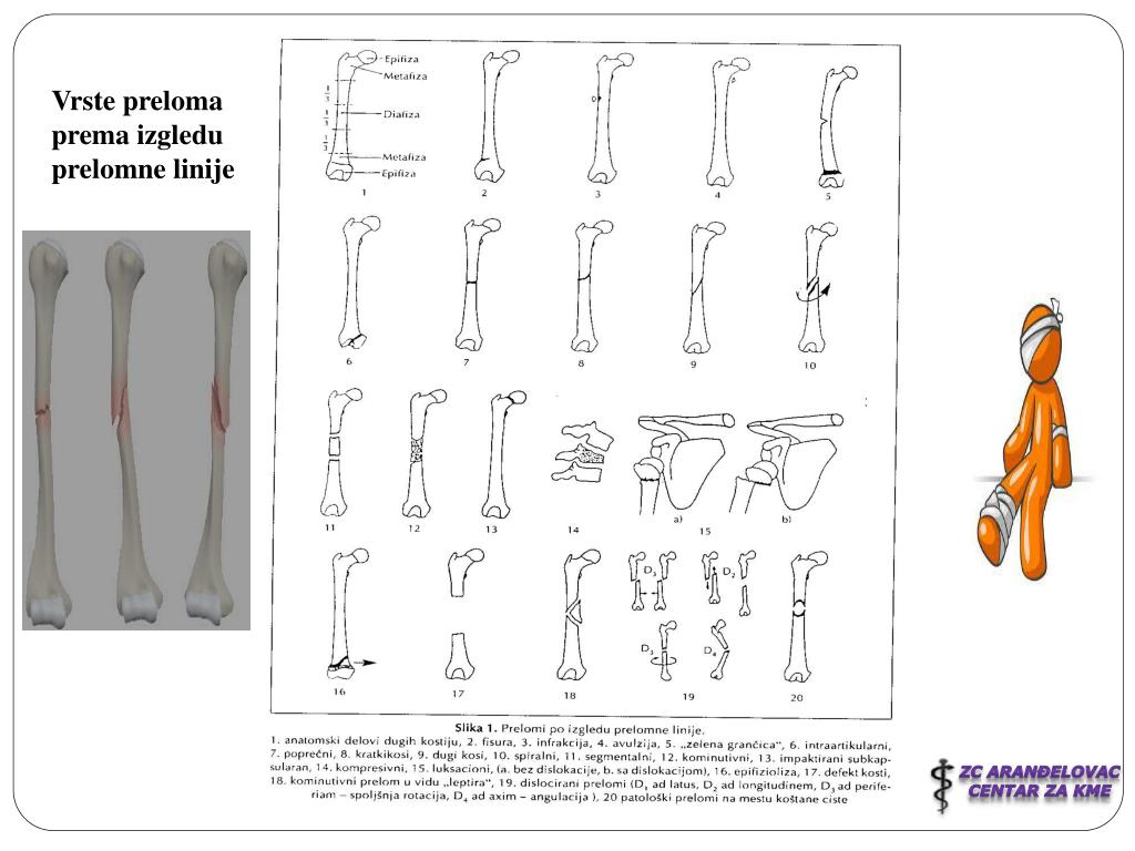 PPT - pripremio i obradio: Dr Sekula Vujović spec. urgentne medicine ...