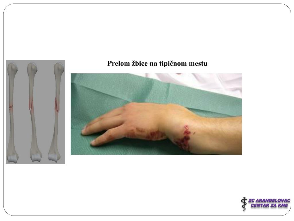 PPT - pripremio i obradio: Dr Sekula Vujović spec. urgentne medicine ...