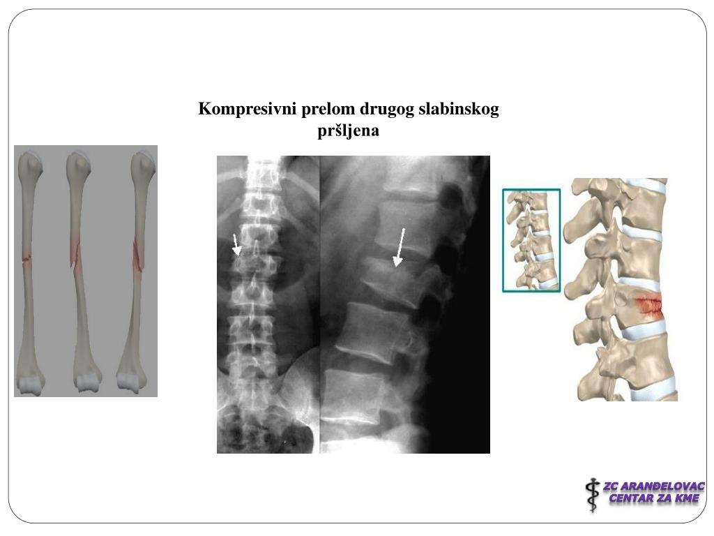 PPT - pripremio i obradio: Dr Sekula Vujović spec. urgentne medicine ...